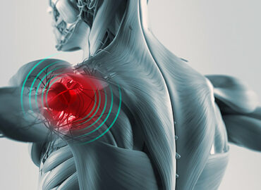 The Best Shoulder Exercises You've Never Even Tried